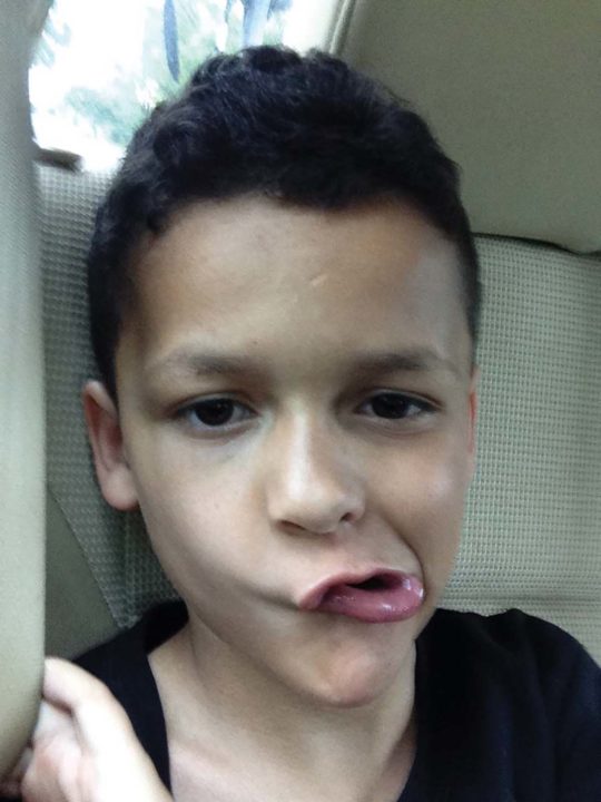 Why Did Jamel Myles Die?